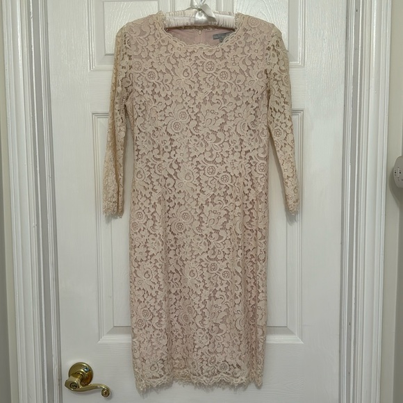 H&M | Dresses | Hm Lace Dress | Poshmark